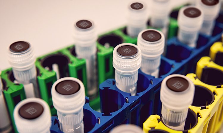 Specimen Tracking Tech: Barcodes vs RFID vs IoT — How to Choose ...